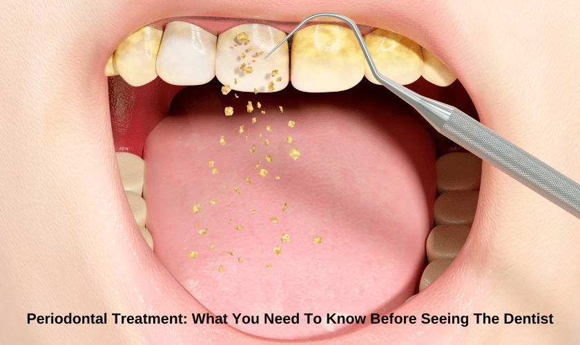 Periodontal Treatment: What You Need To Know Before Seeing The Dentist?