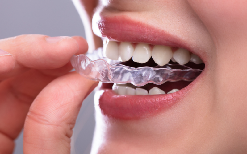 Can Invisalign Fix Crooked Teeth? Discover The Truth